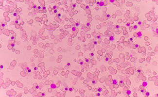 JAI | JAI cameras for supreme color imaging in medical and life…